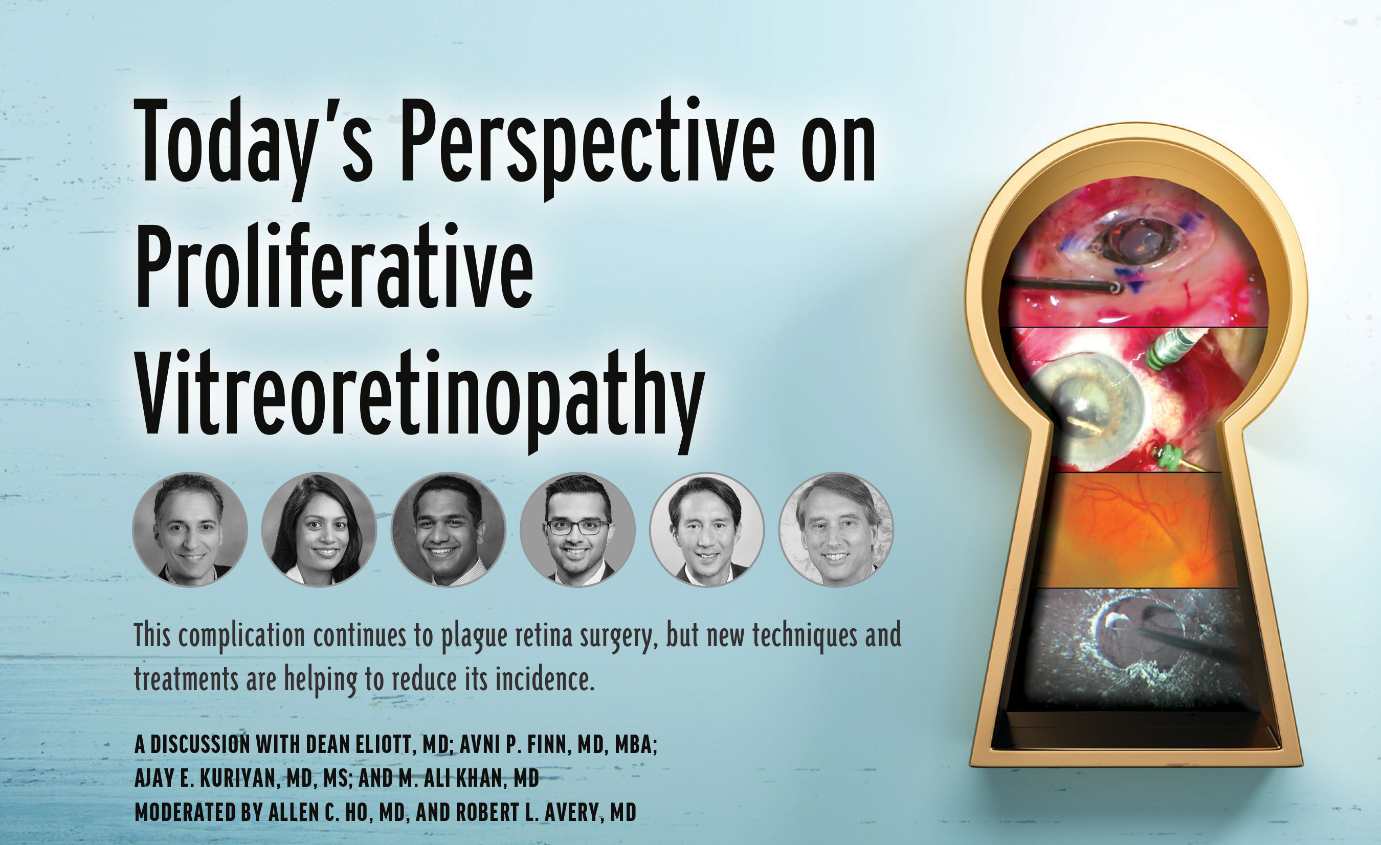 Today’s Perspective on Proliferative Vitreoretinopathy - Retina Today