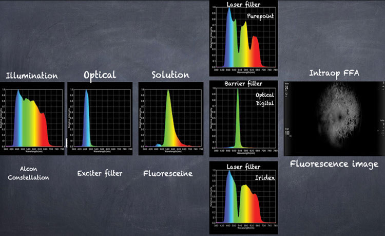 The Ins and Outs of Intraoperative FA - Retina Today
