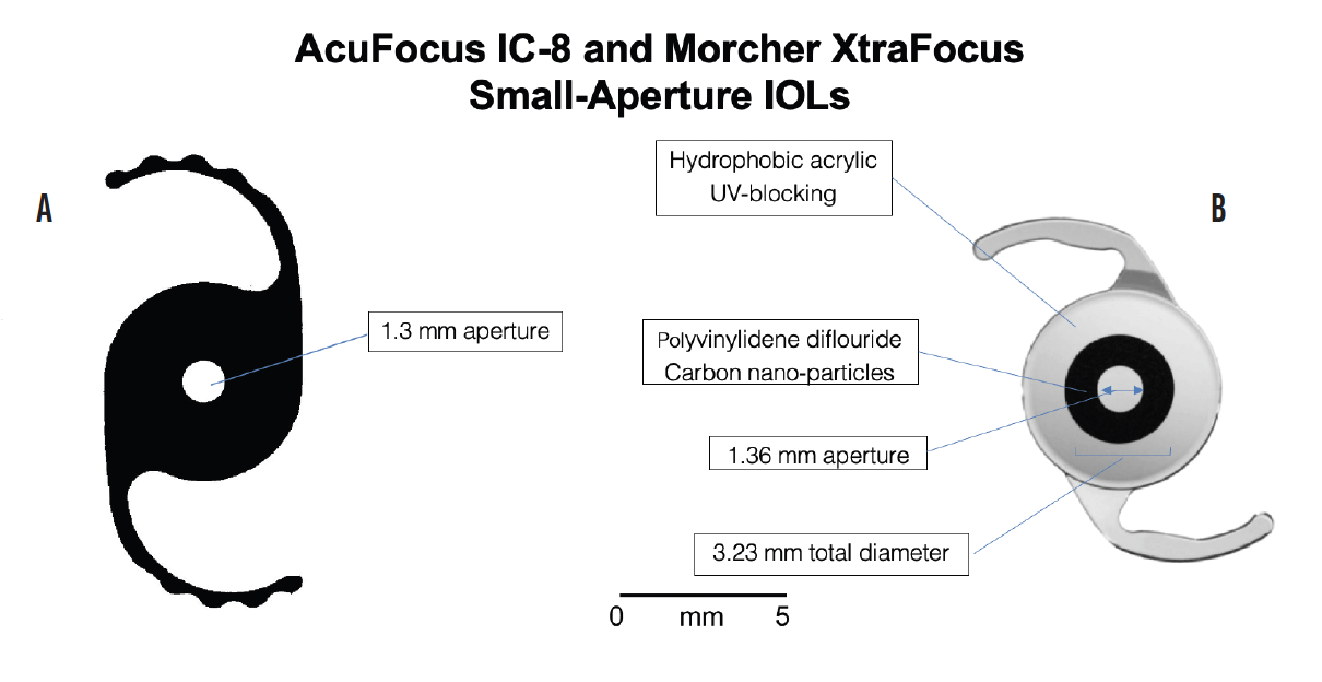 What Is the Optimal Pupil Size? - YoungMD Connect