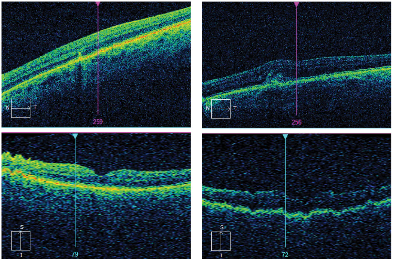 At-Home Monitoring in Your Office - Retina Today