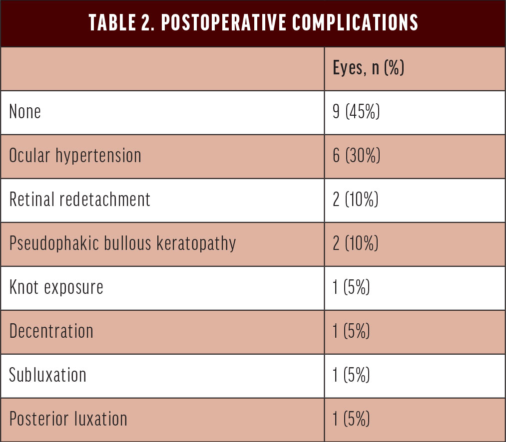 Surgical Technique for Scleral-Fixated IOLs - Retina Today