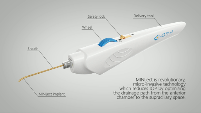 Miniject: Harnessing the Drainage Power of the Supraciliary Space ...