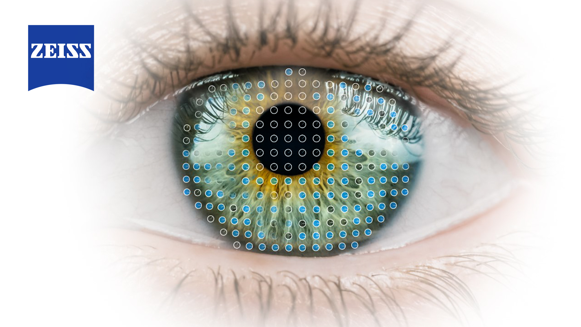 Zeiss Medical Ecosystem - Eyewire+
