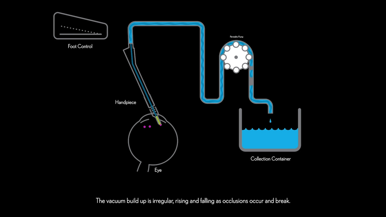 Take Control in the OR with Stellaris Elite® - Eyetube