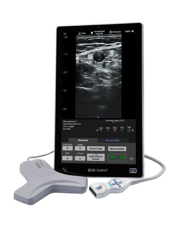 BD’s SiteRite 9 Vascular Access Ultrasound System Launched in United ...