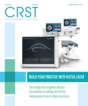 The Victus Femtosecond Laser for Cataract Surgery - Eyetube
