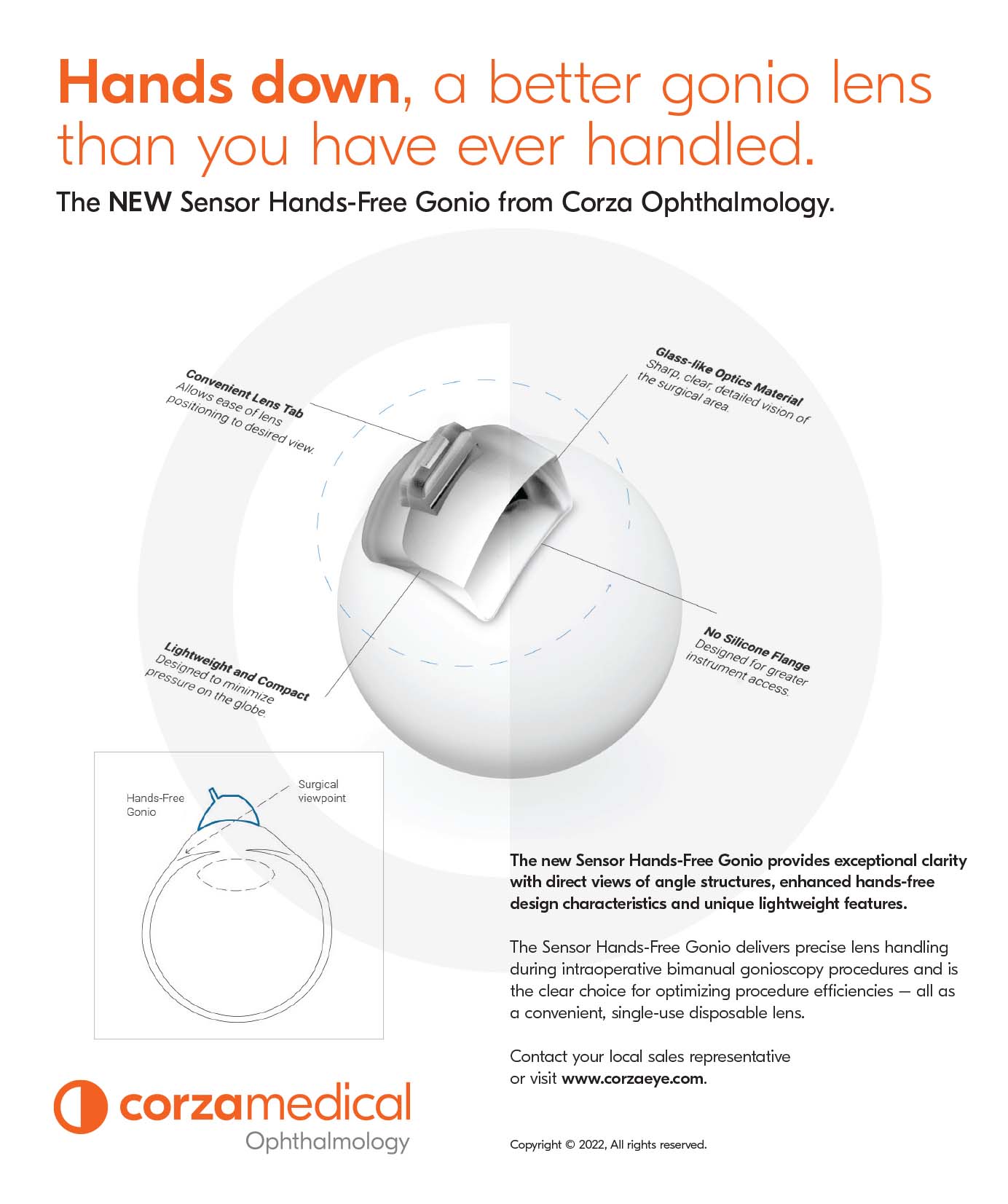 Goniotomy: What Size Is Best? - Glaucoma Today