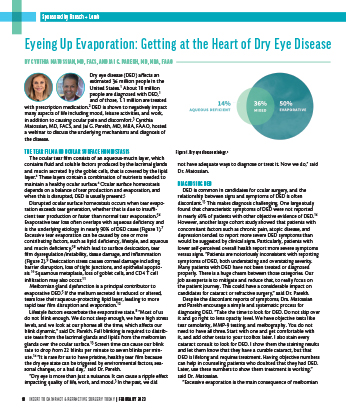 Address the Signs and Symptoms of Evaporative Dry Eye Disease - Eyetube
