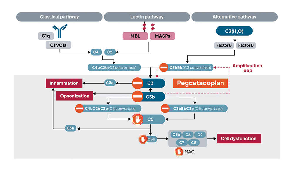 The Evolving Treatment Paradigm in Geographic Atrophy - Retina Today