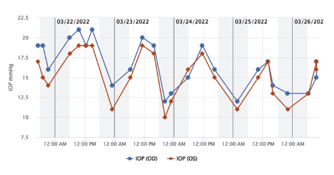 Glaucoma or Long COVID - Glaucoma Today