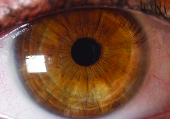 Five Rules of Thumb for Managing the Ocular Surface - Modern Optometry