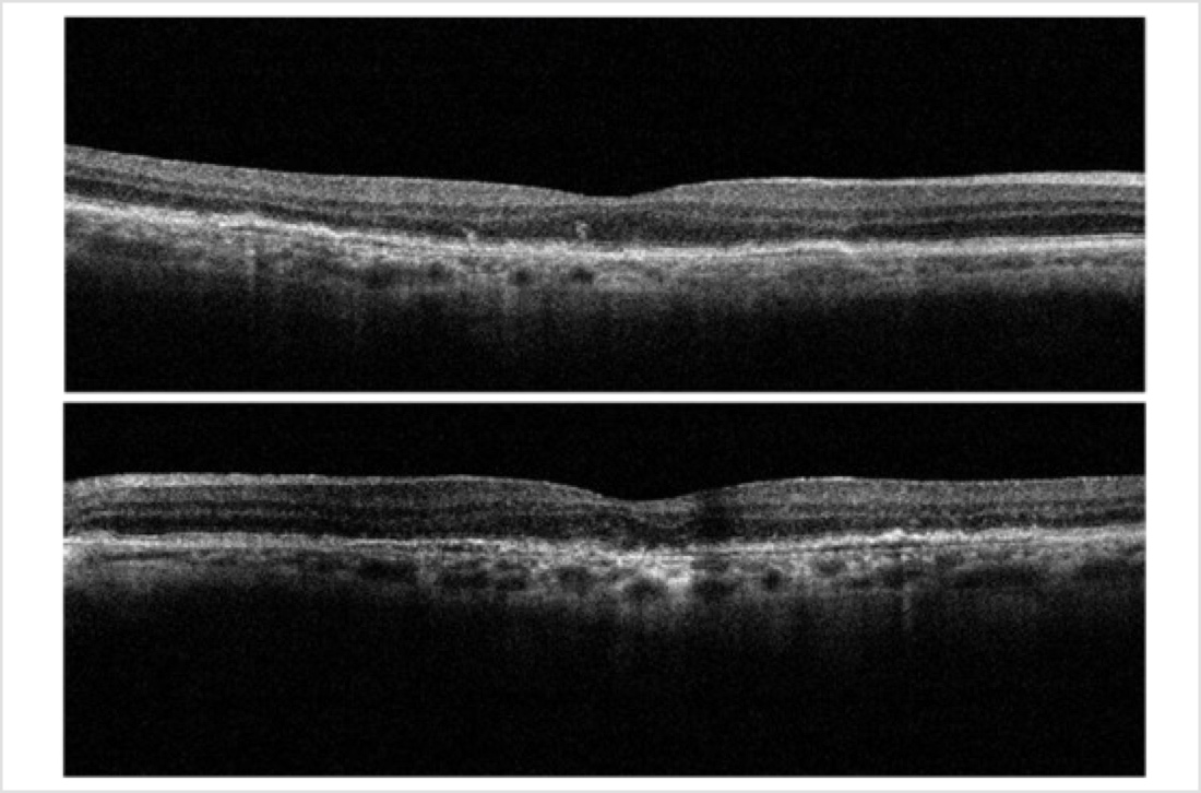 GA Case Compendium: The Optometrist as Advocate for the Patient with ...
