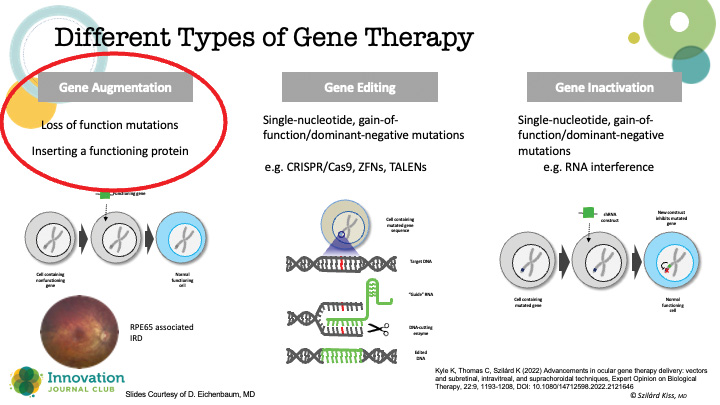 An Inside Look at Innovations in Ophthalmology: Real-World Data on MIGS ...