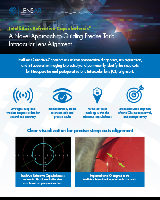 Toric IOL Placement With LENSAR IntelliAxis - Eyetube
