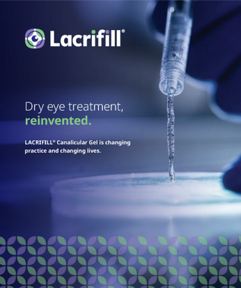 Administering LACRIFILL® Canalicular Gel as an In-Office Procedure ...
