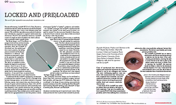 Masterka® | Pushed Monocanalicular Nasolacrimal Intubation - Eyetube