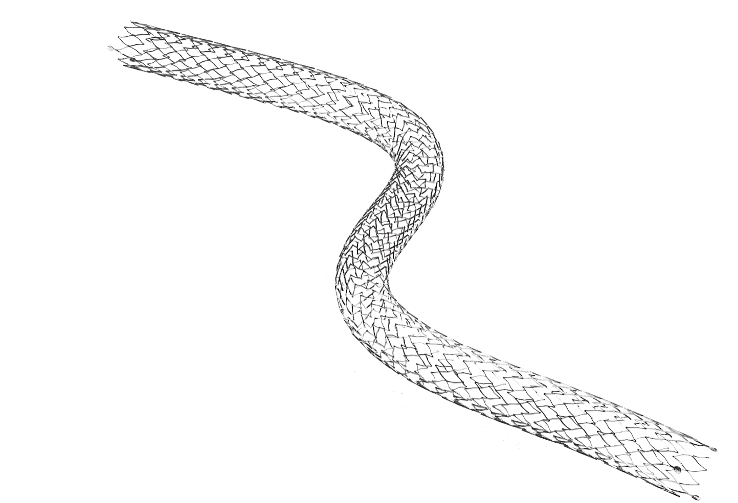 Optimed’s Tentos 4-F Stent System Launched in Europe and Other CE Mark ...