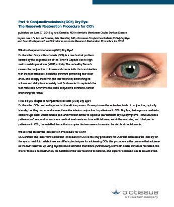 Addressing Mechanically Induced Dry Eye - Eyetube