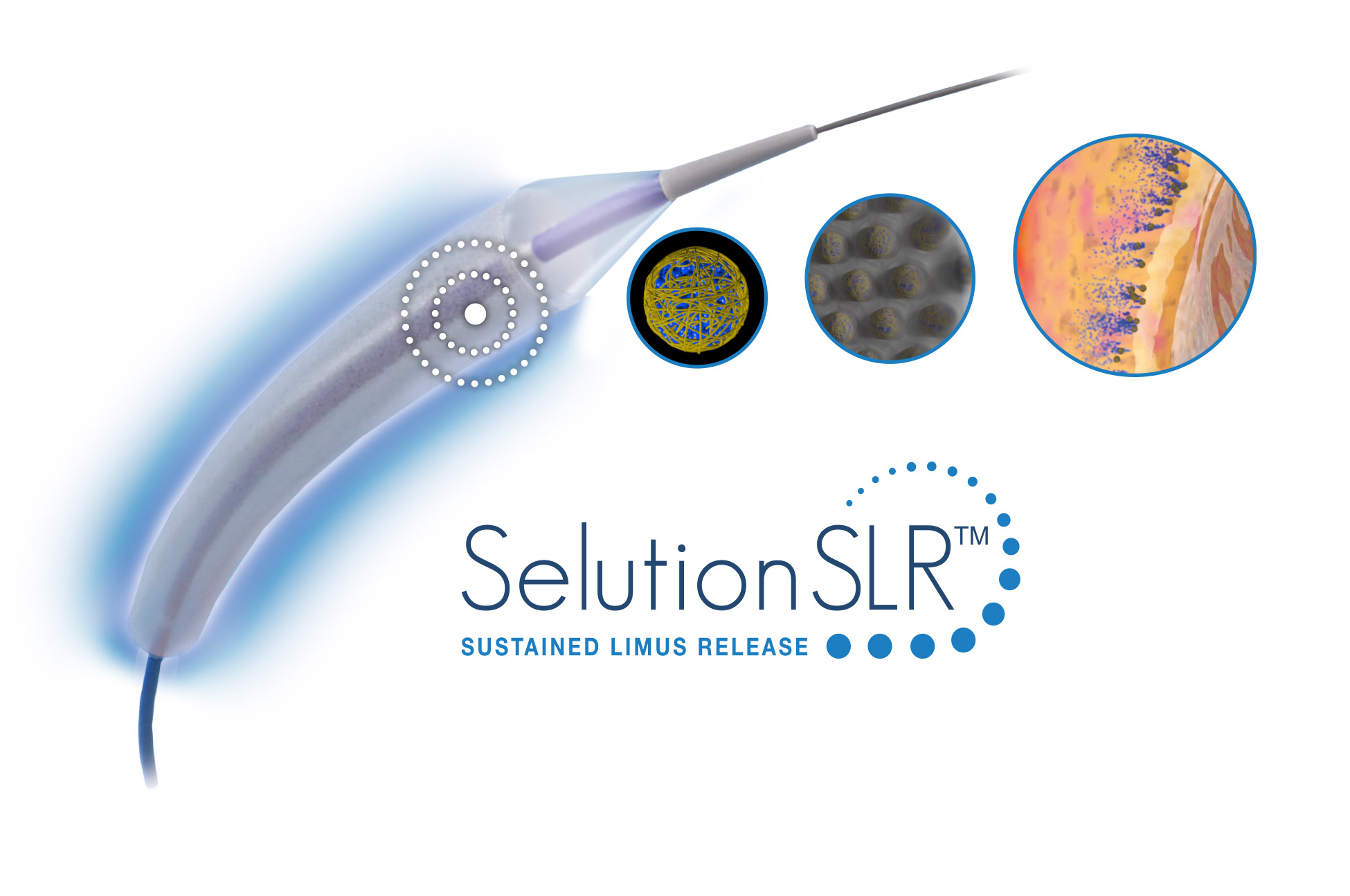 12 Month Data Presented For Medalliances Selution Slr In Btk Lesions