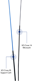 Transit Scientific’s XO Cross Catheter Platform Approved in Europe for ...