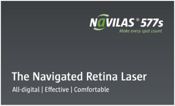 A video introduction to navigated retinal laser therapy with Navilas ...