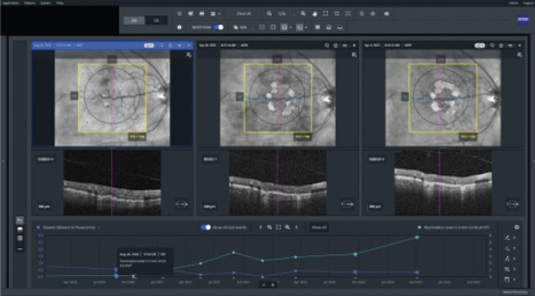 Zeiss Retina Workplace at Alison Mclemore blog