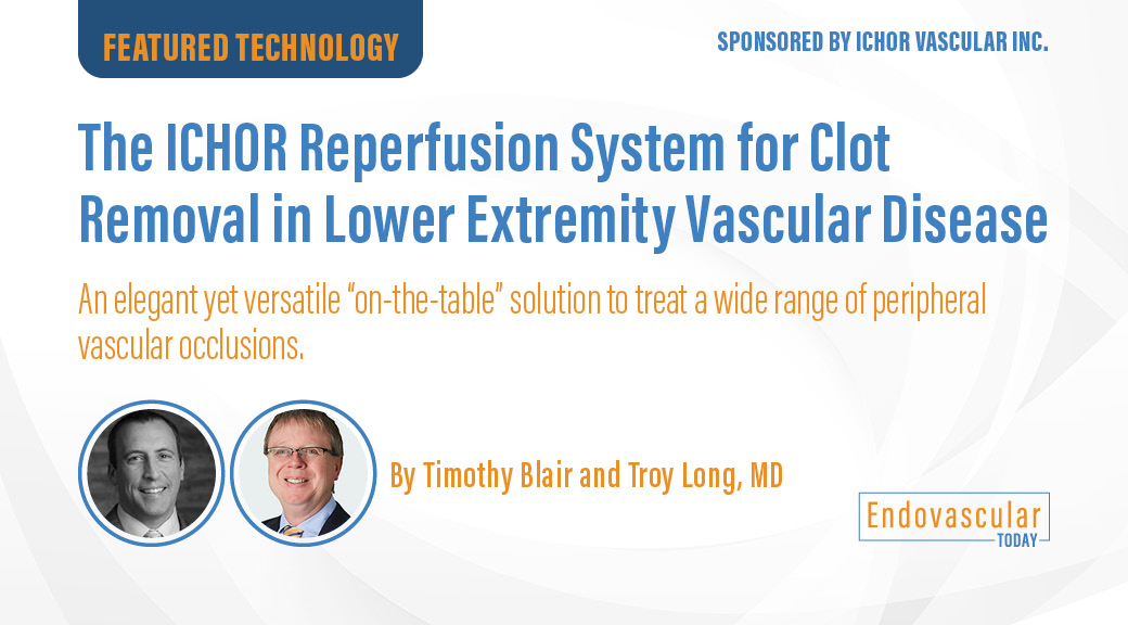The ICHOR Reperfusion System for Clot Removal in Lower Extremity ...