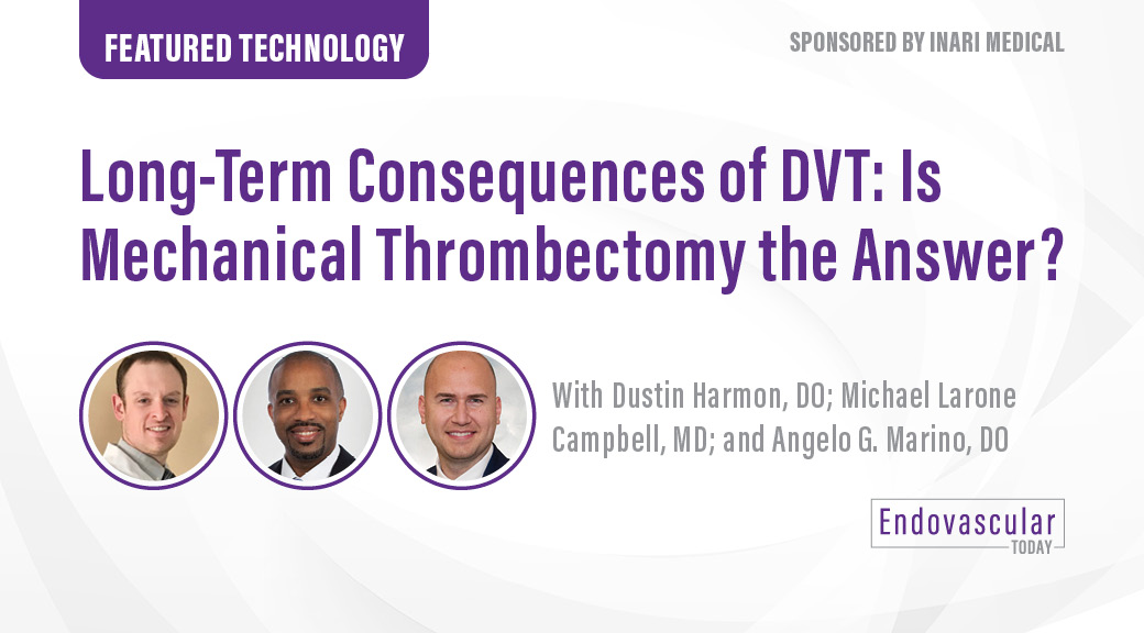Long-Term Consequences of DVT: Is Mechanical Thrombectomy the Answer ...