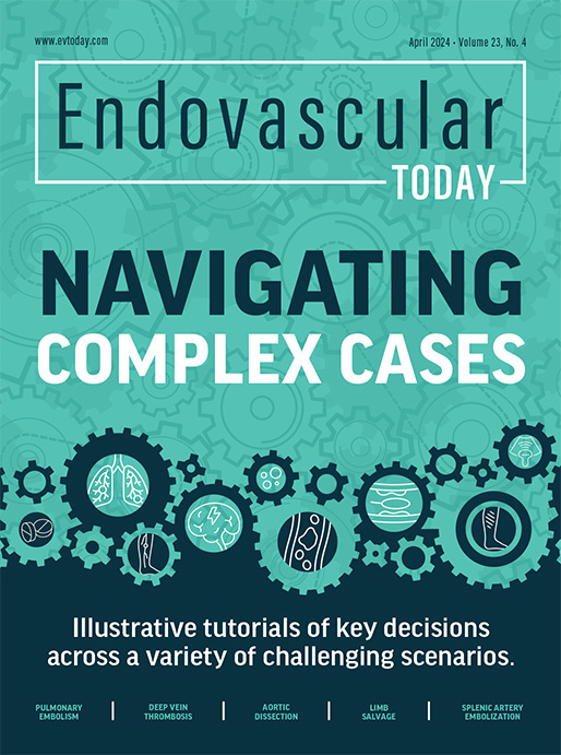 Neurointervention - Endovascular Today