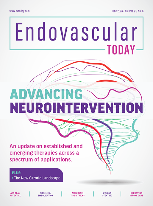 Neurointervention - Endovascular Today