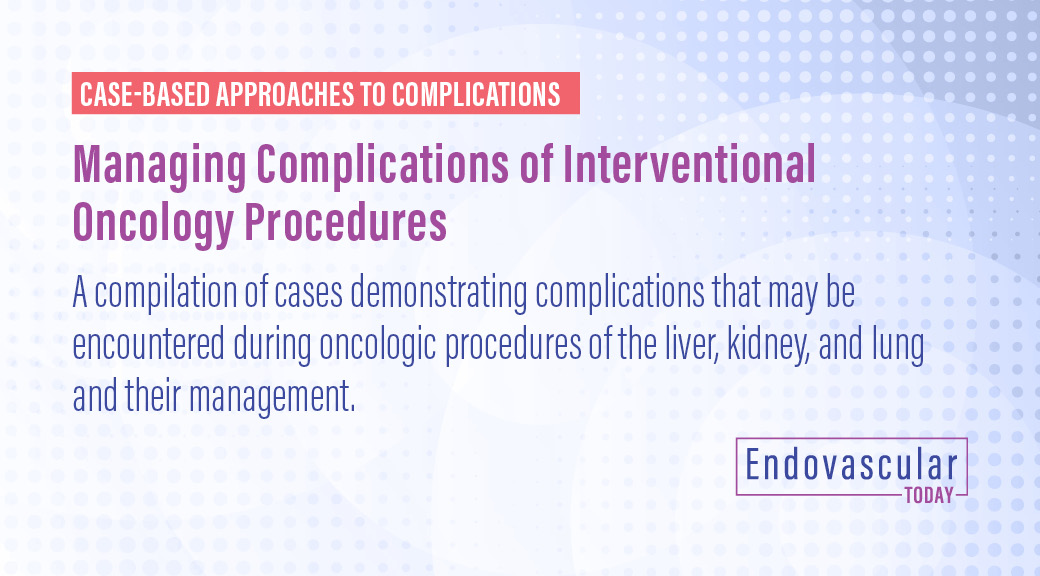 Managing Complications of Interventional Oncology Procedures ...