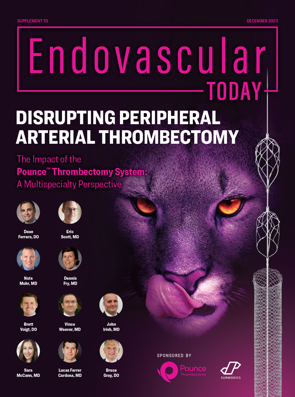 Overview of the Pounce™ Thrombectomy System - Endovascular Today