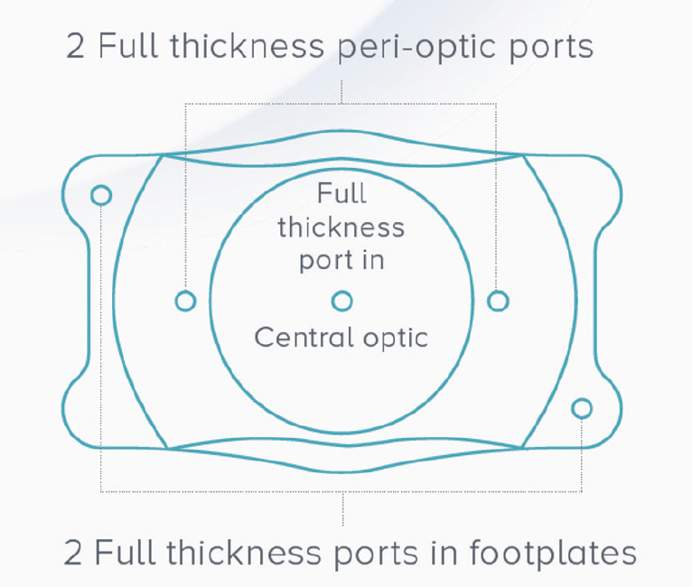 Phakic IOL Surgery - YoungMD Connect