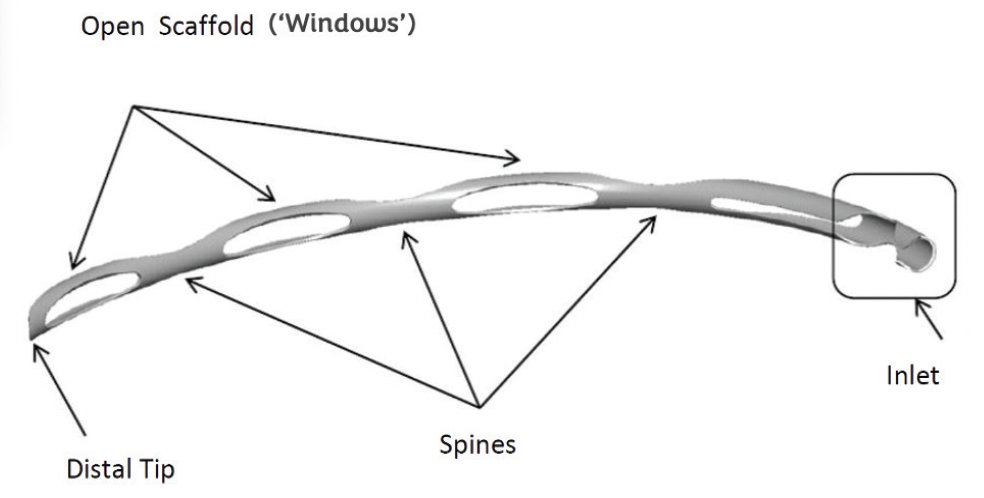 Insertion Pearls for The HYDRUS Microstent - Glaucoma Today