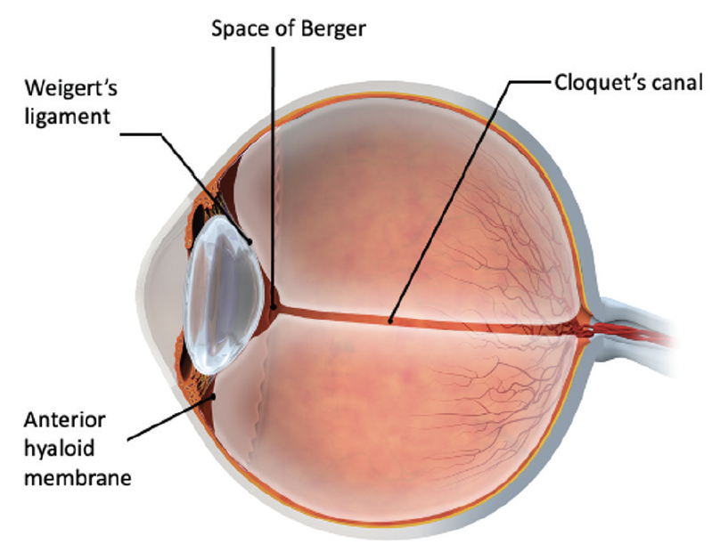 The Benefits of Performing Cataract Surgery at a Lower, More Physiological IOP - YoungMD Connect