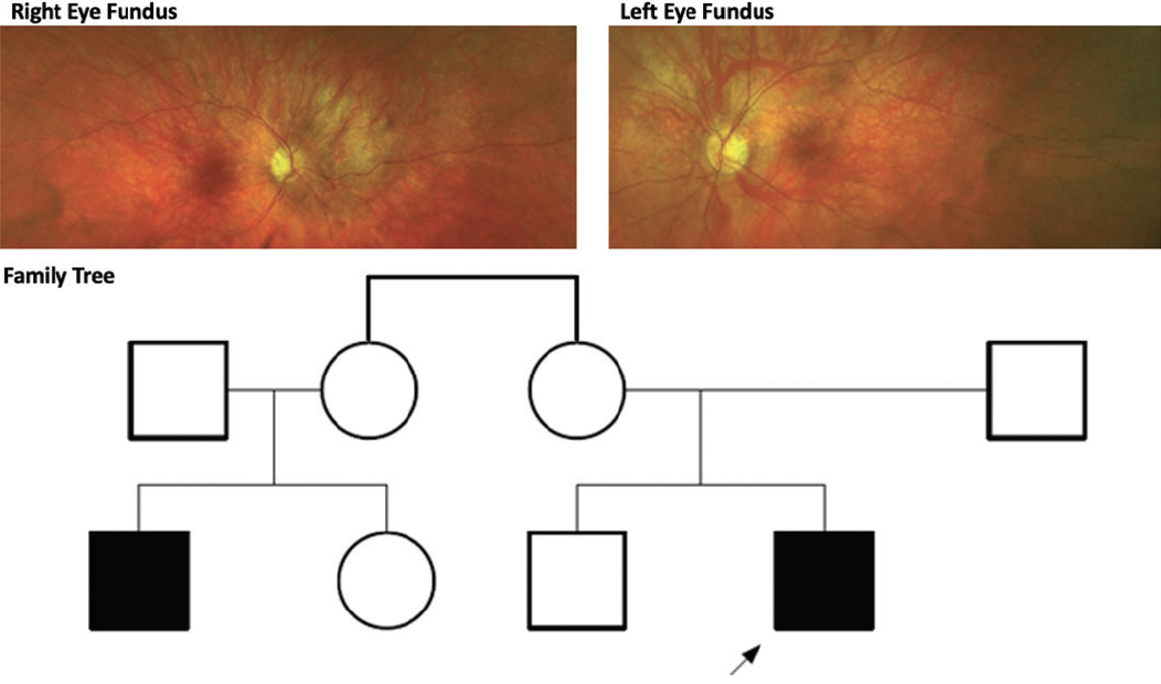 Fundamentals of the Diagnosis and Management of Inherited Retinal ...