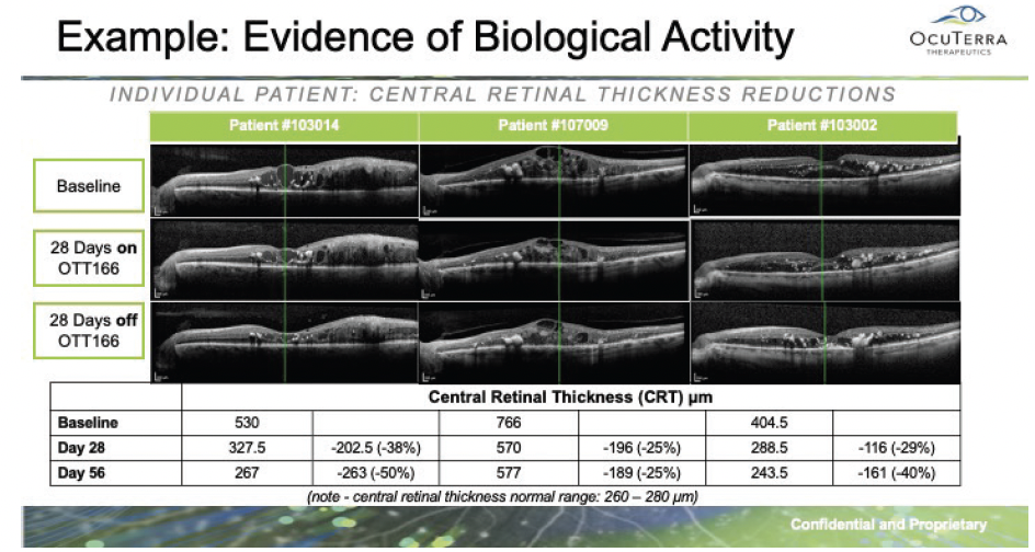 NPDR Practice Patterns in Real-World Practice - Retina Today