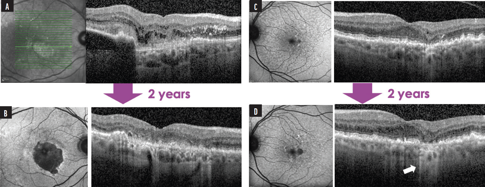 Case Studies - Retina Today