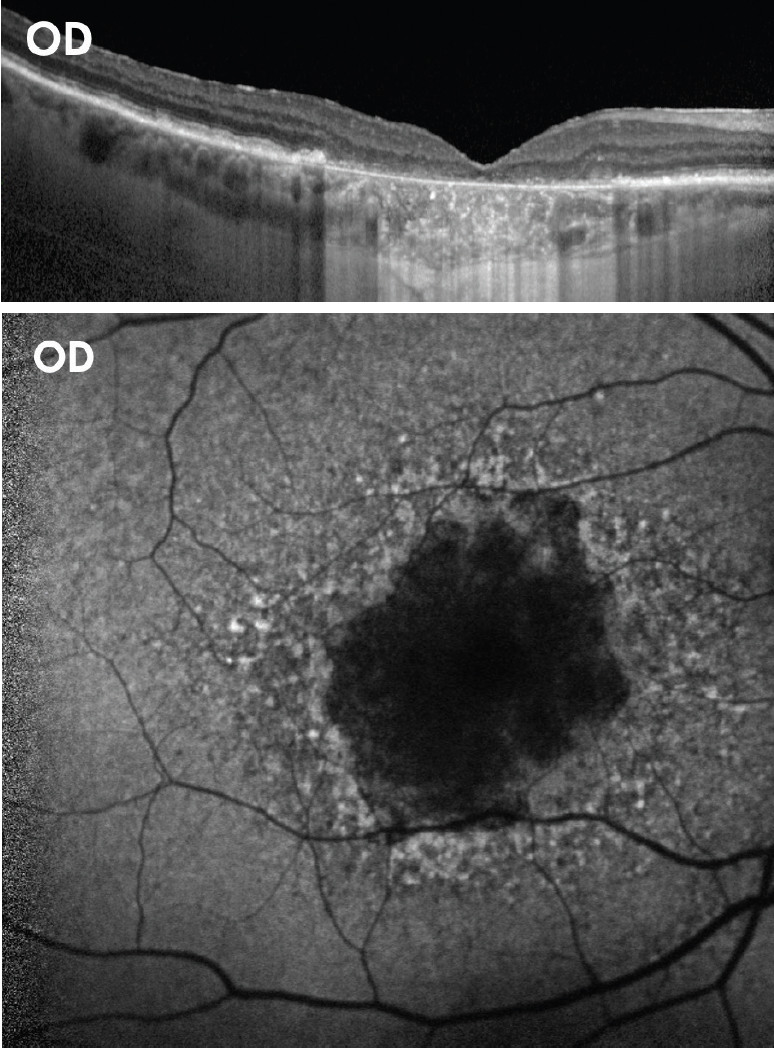 Case Studies - Retina Today