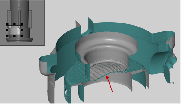 SYFOVRE: Insights on Case Reports of Retinal Vasculitis and Removal of ...
