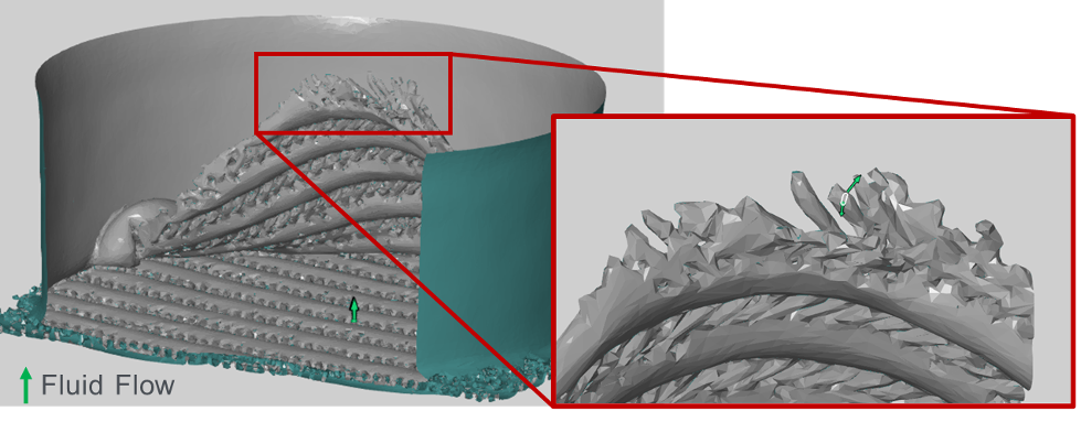 SYFOVRE: Insights on Case Reports of Retinal Vasculitis and Removal of ...