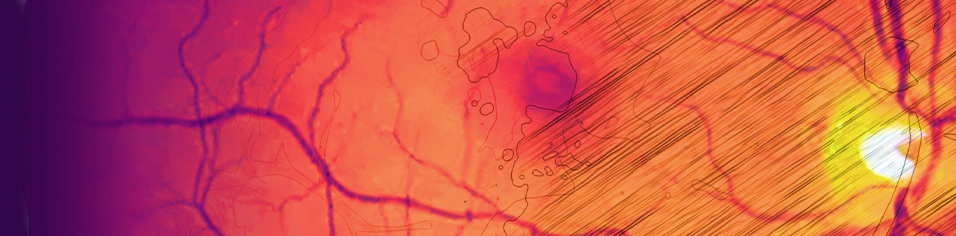 The Art of Drug Choice - Retina Today