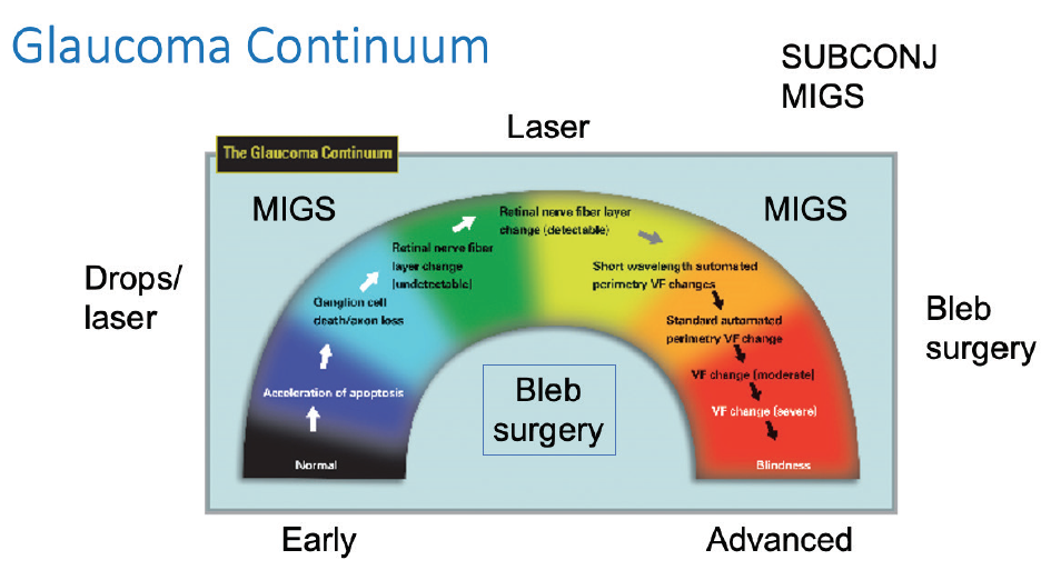 Balancing Safety and Efficacy: Expanding on Current MIGS Offerings ...