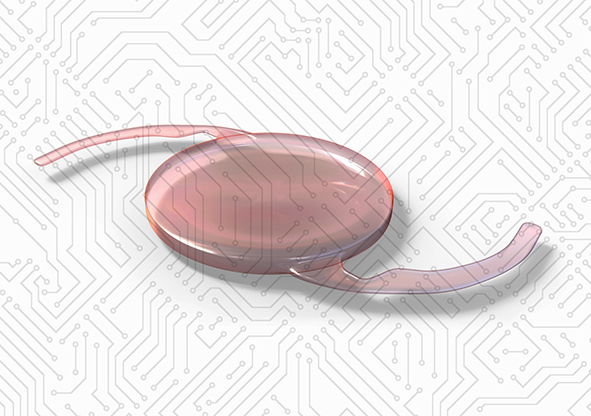 Innovations in IOL Technology - Modern Optometry