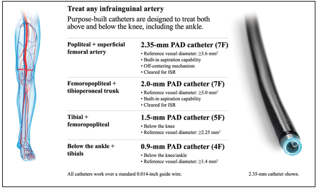 Advancing the Science of Laser Atherectomy for Peripheral Artery ...