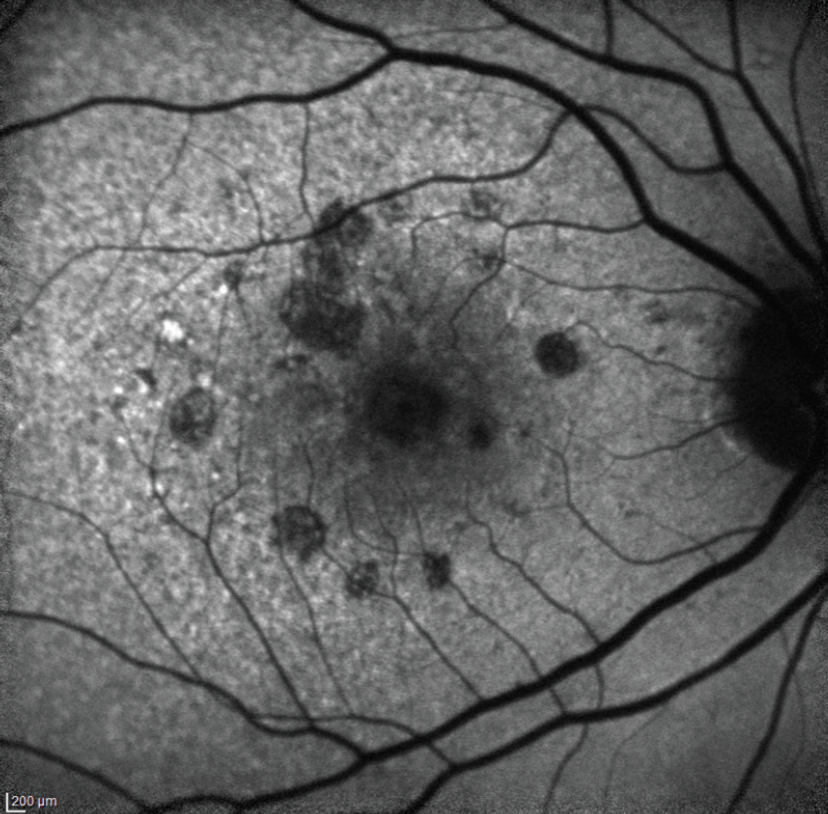 Macular Research on the Move - Retina Today