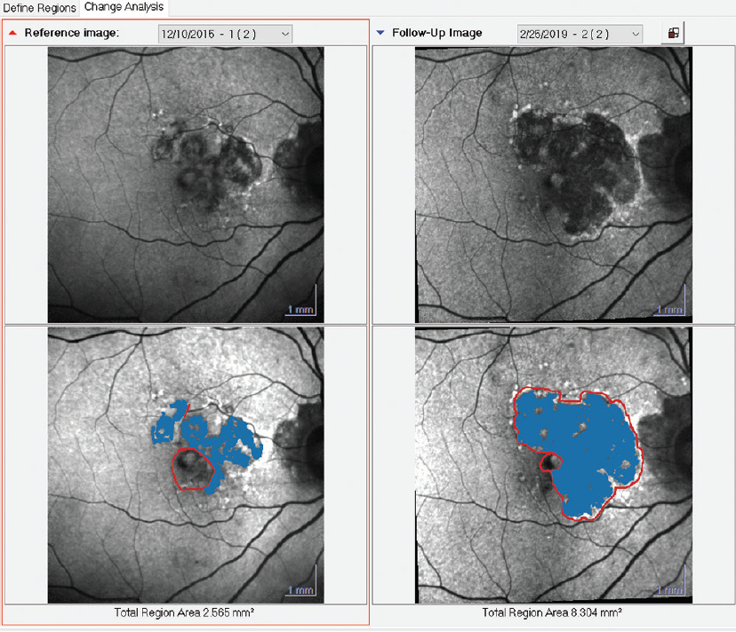 Macular Research on the Move - Retina Today