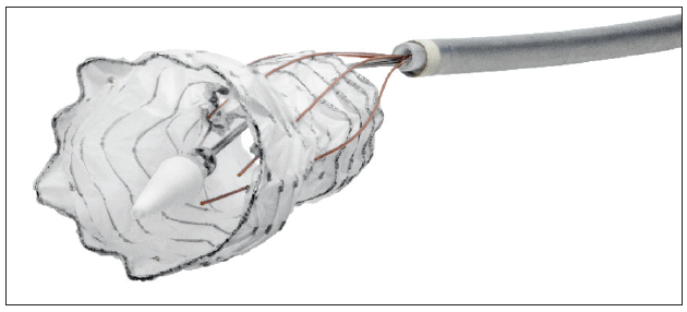 INNER-B Study: Evaluating the JOTEC E-nside TAAA Multibranch Stent ...
