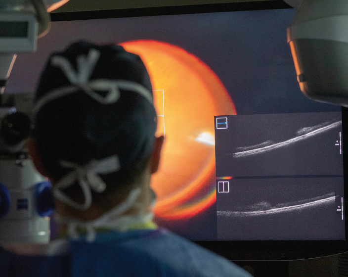 The Ins and Outs of Intraoperative OCT - Retina Today