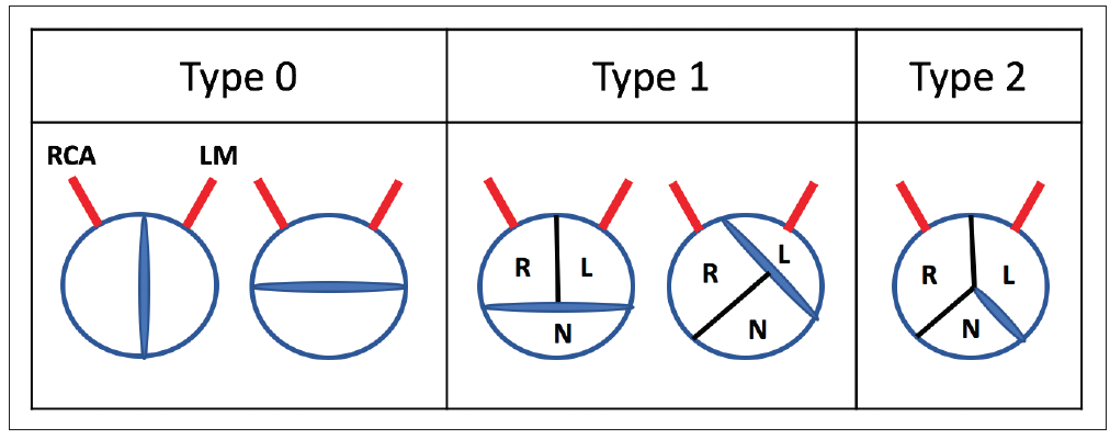 TAVR for Bicuspid Aortic Stenosis: Where Are the Data and What’s Next ...